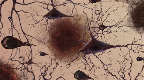 Amyloid Protein Plaques Image Eurekalert Science News Releases