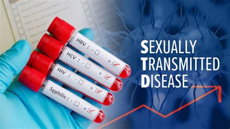 Global Sexually Transmitted Diseases Diagnostics Industry Fmi