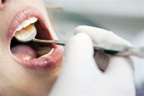 How To Get Rid Of Gum Infection Dental Hygiene Doctorhelps