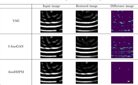 Table From A Study On Unsupervised Anomaly Detection And Defect Localization Using Generative