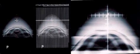 A CT Images Of The Inhomogeneous Water Equivalent Phantom At The Download Scientific Diagram