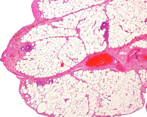 White Adipose Tissue 3 Photograph By Science Photo Library Pixels Merch