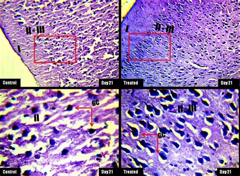 Representative Light Micrographs Of The Lateral Prefrontal Cortex Of Download Scientific