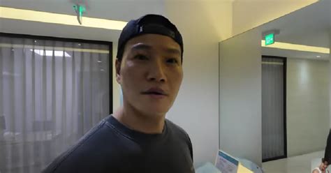 김종국 시술 후 확 달라졌다…외모로 먹고 산 적 없는데 짐종국