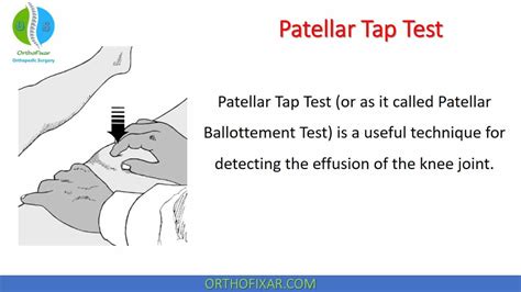 Patellar Tap Test Ballottement Test Orthofixar 2026