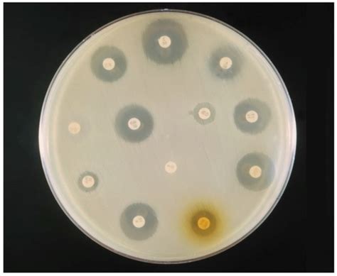 7 3 Kirby Bauer Antimicrobial Test Flashcards Quizlet