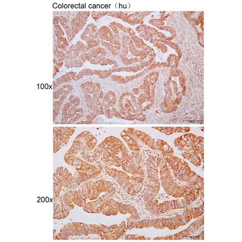 Solarbio K110612p Anti Adat1 Polyclonal Antibody 试剂仪器耗材