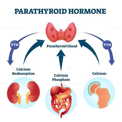 Parathyroid Disease Artofit