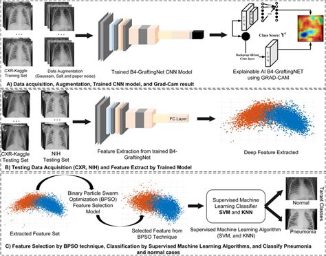 Proposed Methodology Of B4GraftingNet CNN For Pneumonia Classification