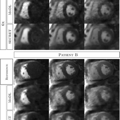 Secret And Modl K 1 Reconstructions Obtained From 6× And 10×