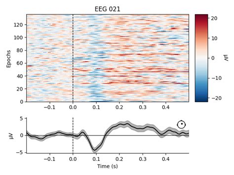 Overview Of Megeeg Analysis With Mne Python — Mne 131 Documentation