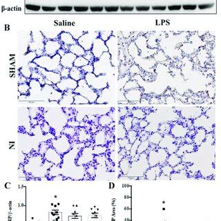 Effect Of 60 Min NAIs Treatment On Beclin 1 Expression In LPS Induced