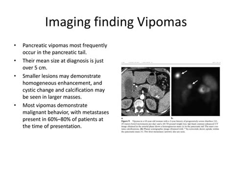 Pancreatic Endocrine Tumor Imaging2pptx