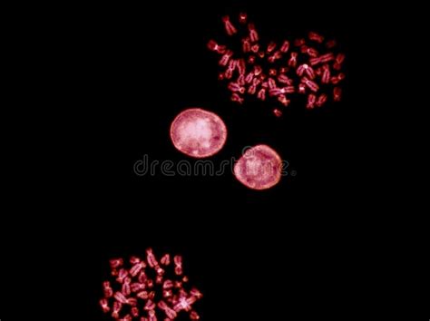 Chromosomes Under Fluorescence Microscope Red Colored Human