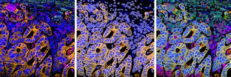 Researchers Gain Deeper Spatial Insights With Multiplexed 2d Image Analysis Tool Leica