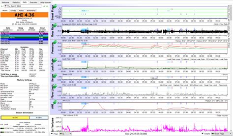 File 20161229Sample Full Data Chart PNG Apnea Board Wiki