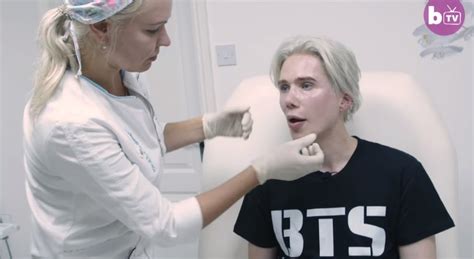 British Fan Spends 100000 On Cosmetic Surgery To Look Like His Bias