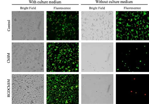 Bright Field And Fluorescence Photographs Of Fibroblasts With And