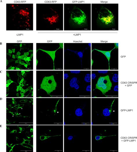 Perinuclear Localization Of Lmp1 Requires Cd63 A Hek293 Cells Were