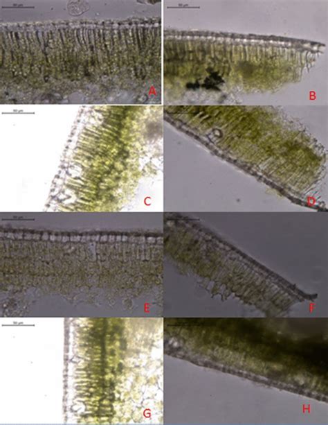 A Oblique Sections Depicting The Dimensions Of Different Tissues Viz