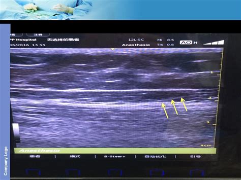 下肢神经阻滞word文档在线阅读与下载无忧文档