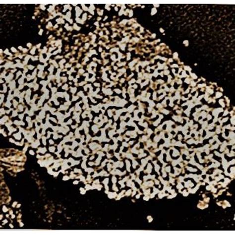 Porosity Structure In β Tcp Dcpd Phbv 40 60 4000× Download