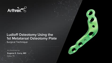 Arthrex First Metatarsal Osteotomy