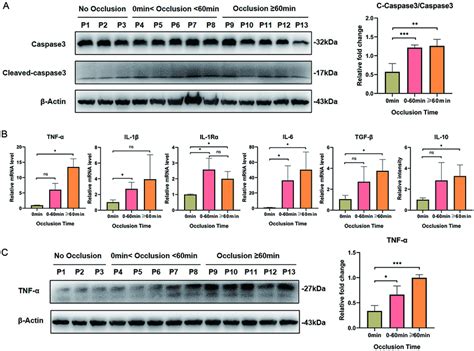 Expression Of Apoptosis And Inflammatory Factors Increased In Clinical Download Scientific