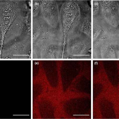 Fast Confocal Spinning Disk Fluorescence Imaging Of Pc3 Cells Treated Download Scientific