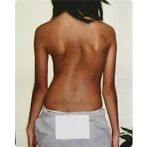 Keypointdetection10spine Keypoint Detection Dataset By Tonmai