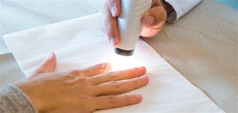 Capillaroscopia Omeopatia Unicista Dott Luca Garavini