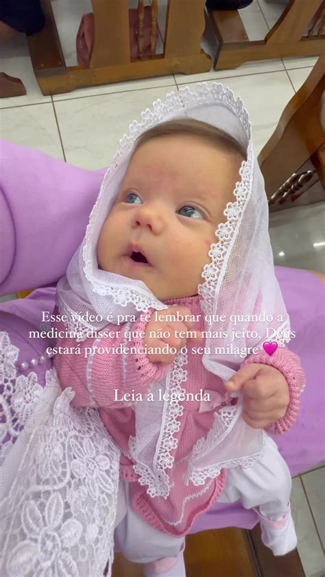 Eritroblastose Fetal Bebe Bryan Dyer Erythroblastosis Fetalis