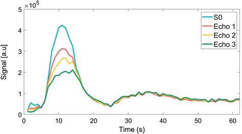 The Main Bolus Arterial Input Functions Aifs After Dixon Moco For