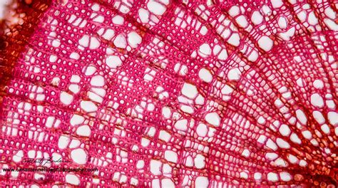Plant Cell Under Microscope 400x