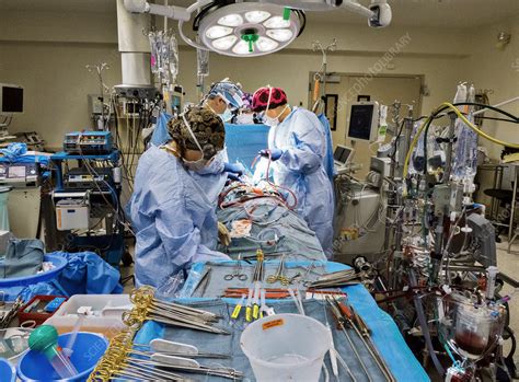 Open Heart Surgery Stock Image C038 0694 Science Photo Library