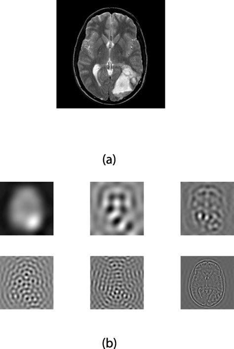 EWT Decomposition Example A Tumor MR Image B Six EWT Sub Band Coefficients Download