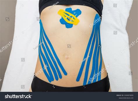 젊은 여자 복부에 있는 키네시오 테이프 스톡 사진 2200879095 Shutterstock