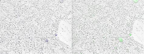 Dapi Staining On Fixed With Formaldehyde Caco 2 Cells Illustrating