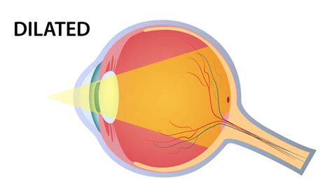 Dilated Eye Exams Eye Deology Vision Care Edmonton Optometrists