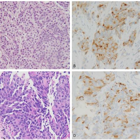 Ex Vivo Verification Of Psma Expression In Du145 Psma And Du145