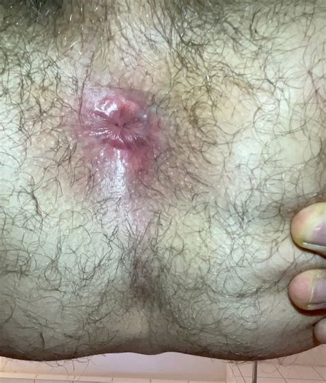 My Hairy Asshole 6 Nude Pics XHamster