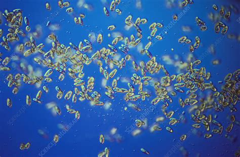Chilomonas Lm Stock Image C009 4868 Science Photo Library