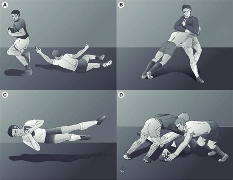 Shoulder Dislocation Cases In Rugby A Diving Tackler Try Scorer