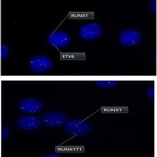 Interphase FISH A ETV RUNX B RUNX RUNX T Download Scientific Diagram