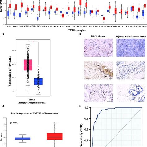 Hmgb3 Expression Levels In Various Cancer Types A Ualcan Database