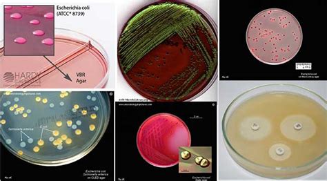 E Coli Escherichia Coli An Overview Microbe Notes