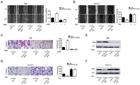 A Decrease In Histone Acetylation Is Required For The Anti Metastatic