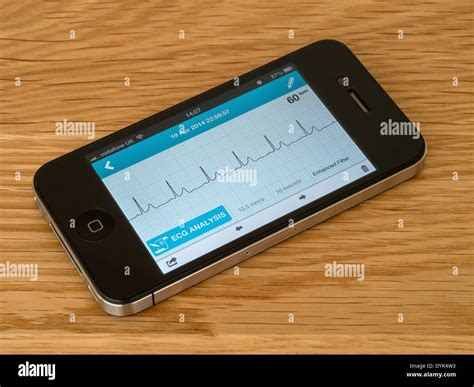 Normal Ecg High Resolution Stock Photography And Images Alamy