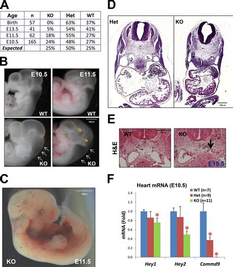 commd9 deficiency leads to embryonic lethality and complex