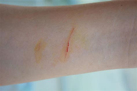 Cut Arm With Blade